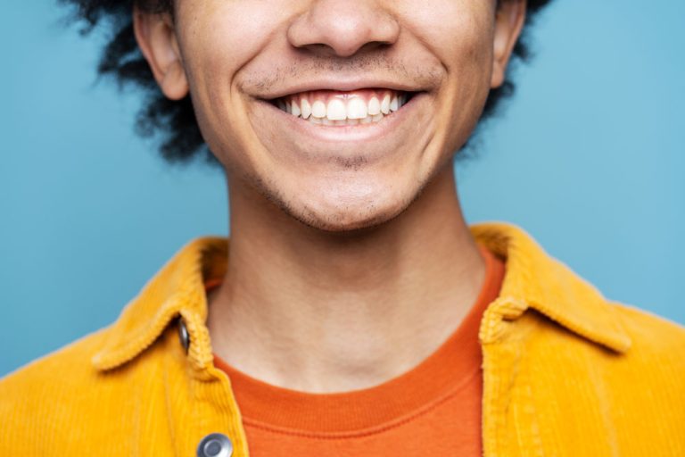 Six Month Braces FAQs - Rapid Braces